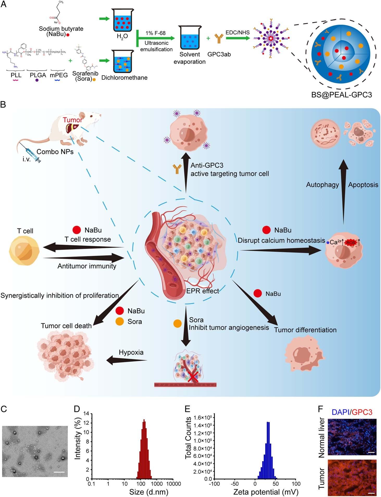 项目文章 | 肠道菌群代谢物丁酸盐通过调节细胞内钙稳态影响抗癌治疗 - 知乎