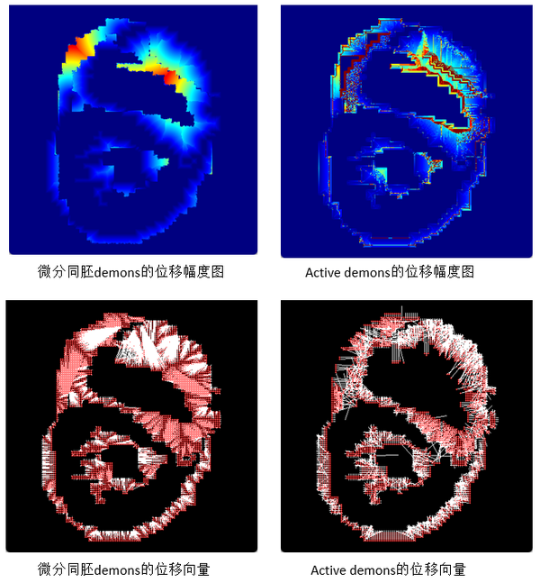 传统配准/Demons/微分同胚demons - 知乎