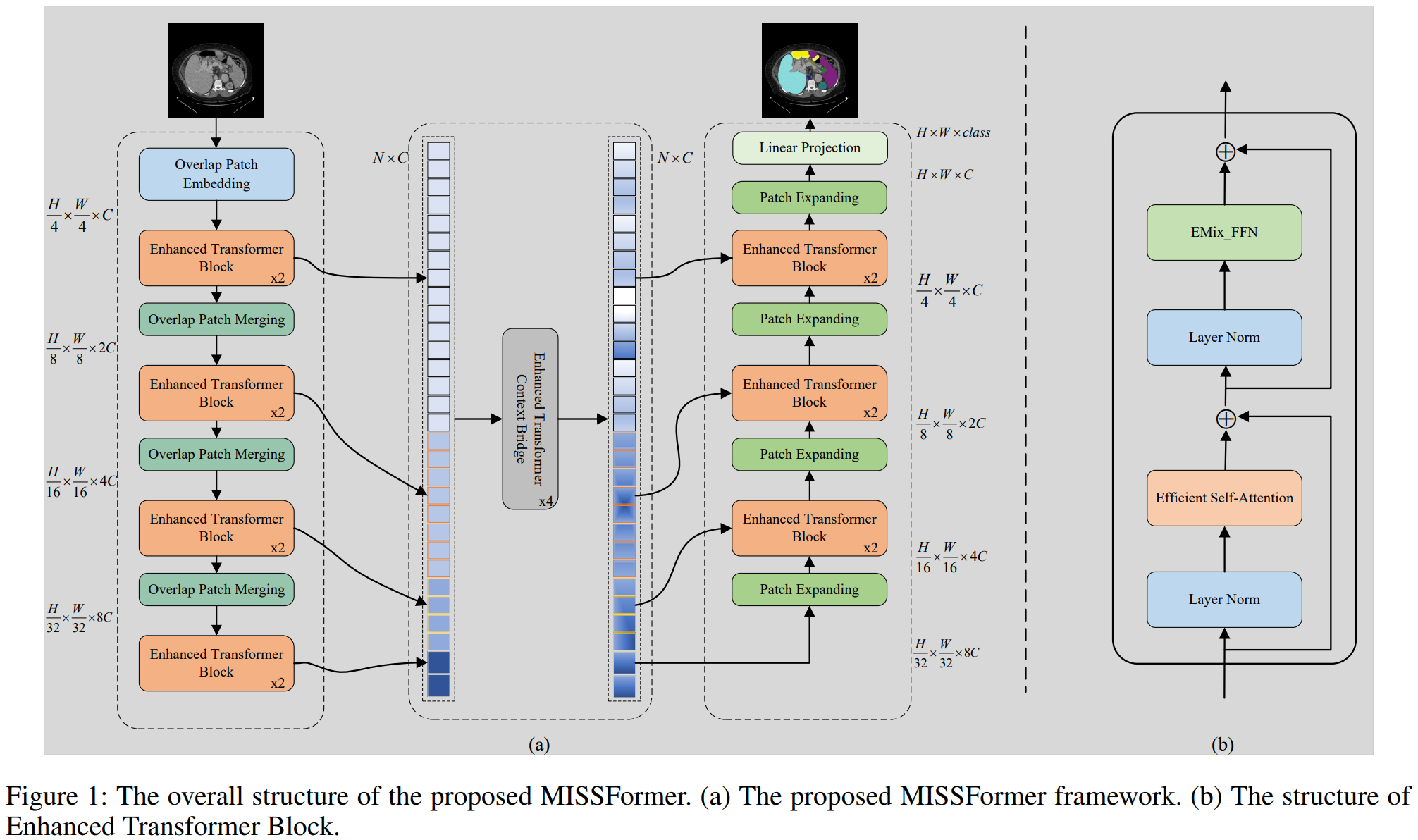 【TMI 2023】MISSFormer：一种用于2D医学图像分割的高效Transformer（MISSFormer） - 知乎