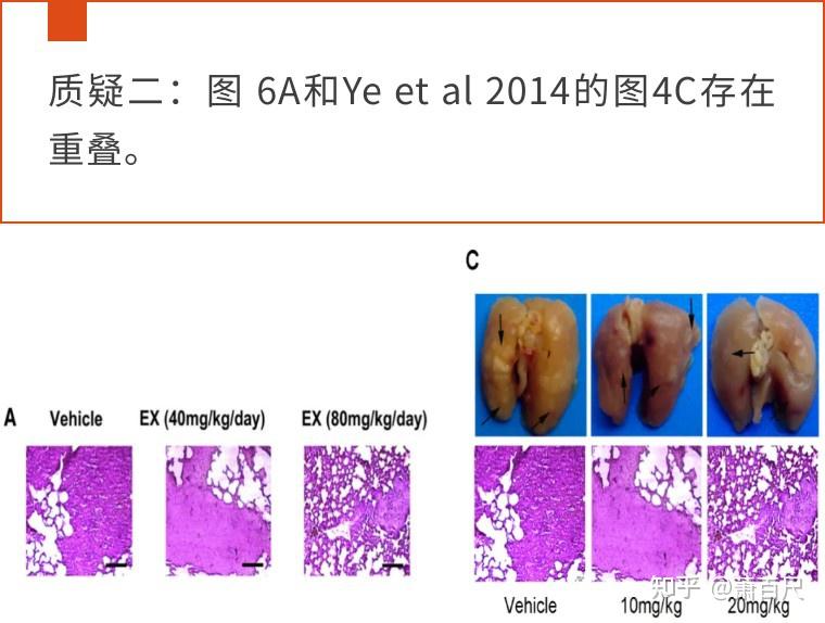 安徽蚌埠医学院第一附属医院论文因结论不可靠被撤稿 - 知乎