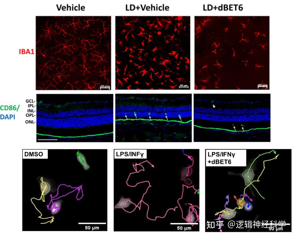 J Neuroinflammation︱中山大学中山眼科中心龚莉莉/李万程报道在新型PROTAC药物dBET6在光损伤中保护视网膜并抑制 ...