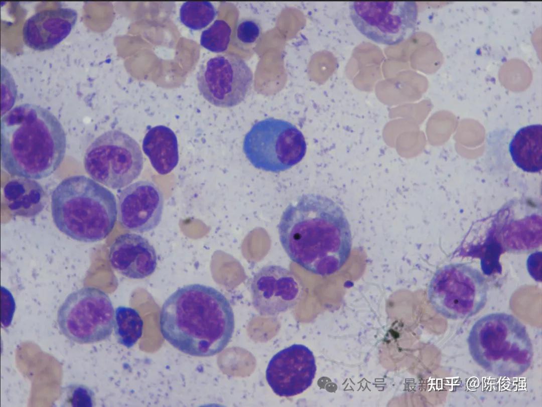 多模态大模型CLIP，BLIP，BLIP2之图像文字描述，视觉问题回答，图像分类 - 知乎