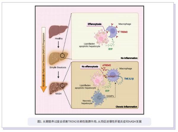 文献解读 | 长期营养过度损害 TREM2 依赖性胞葬作用促进慢性肝脏炎症和 NASH 发展 - 知乎