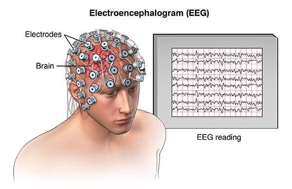 基于脑电波（EEG）的脑机接口（BCI）技术、应用及投资分析(1)-概述 - 知乎