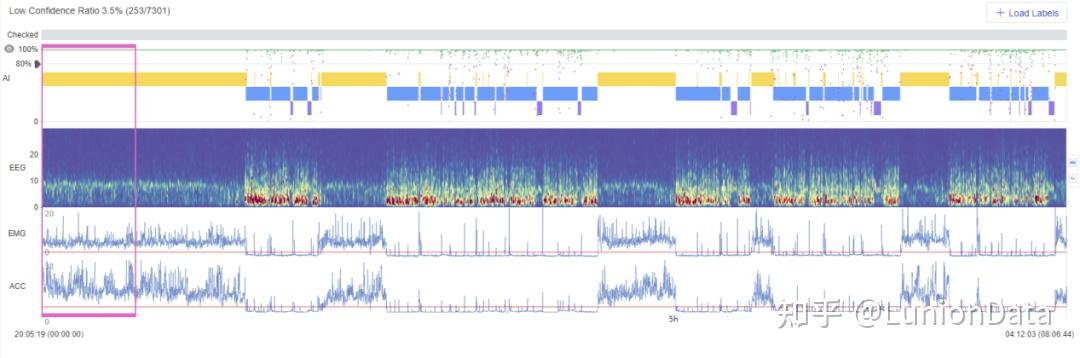 【脑科学】动物睡眠病状中的REM Sleep - 知乎