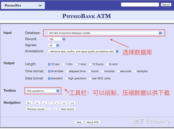 基于硬件树莓派0-Tensorflow的心电图识别 - 知乎
