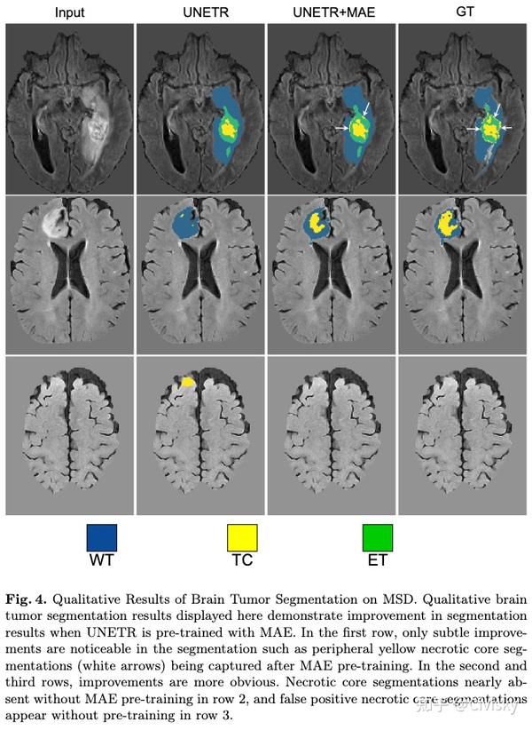 用于医学图像分析的MAE掩码自编码器(速读版) - 知乎