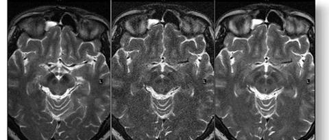 MRI基础知识——SNR与场强的关系 - 知乎