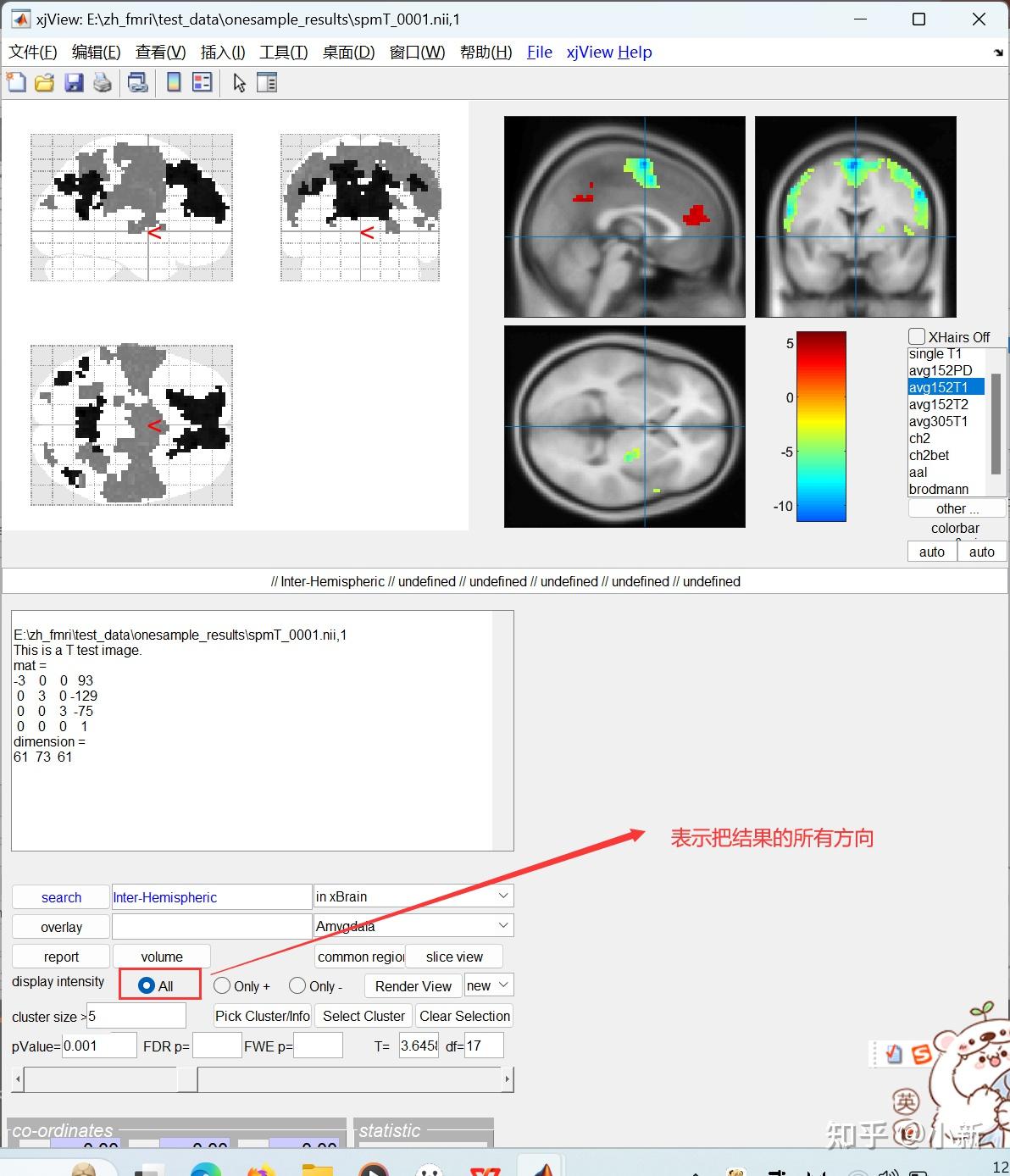 15（1）-SPM-fmri任务态 结果查看与汇报 xjview - 知乎