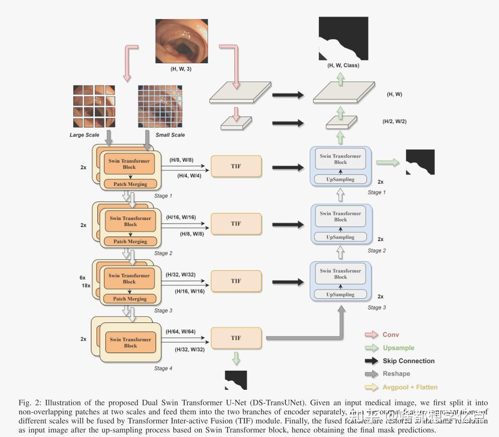 基于transformer-UNet的医学图像分割 - 知乎