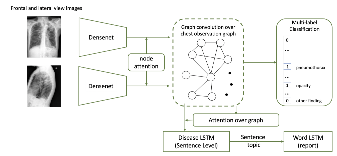 [论文笔记] When Radiology Report Generation Meets Knowledge Graph - 知乎