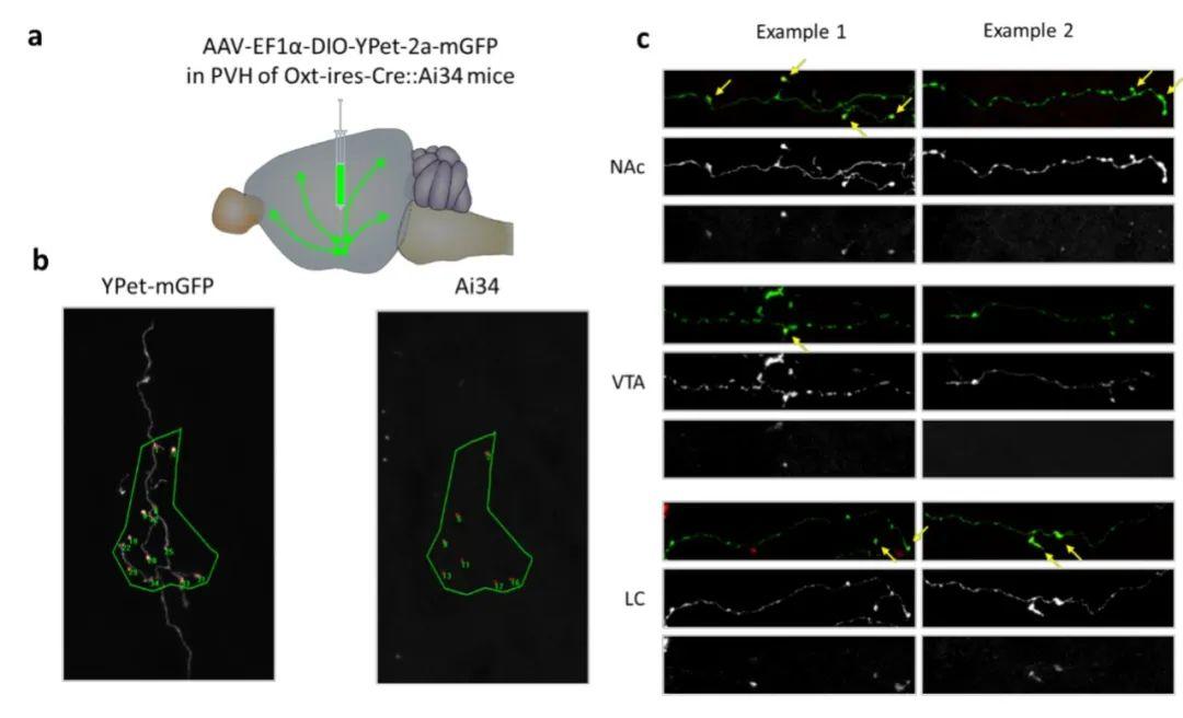 【独家合作】BrainVTA联合北大于翔课题组开发Cre依赖的可标记完整神经元形态的AAV病毒 - 知乎