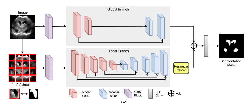 【论文精读-医学图像分割】Medical Transformer: Gated Axial-Attention for Medical ...