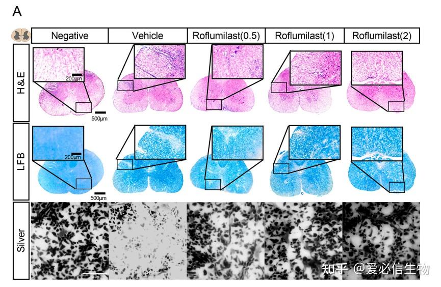 EAE模型 | 罗氟司特调节神经炎症，改善多发性硬化症(MS)的运动功能和抑郁症状 - 知乎