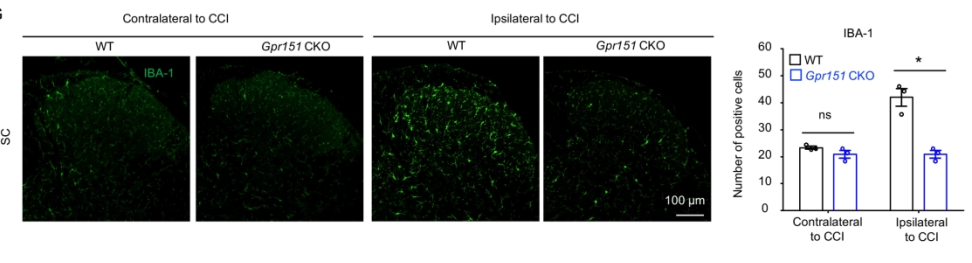 《客户文章》浙江大学徐贞仲团队在神经病理性疼痛研究领域取得进展 - 知乎