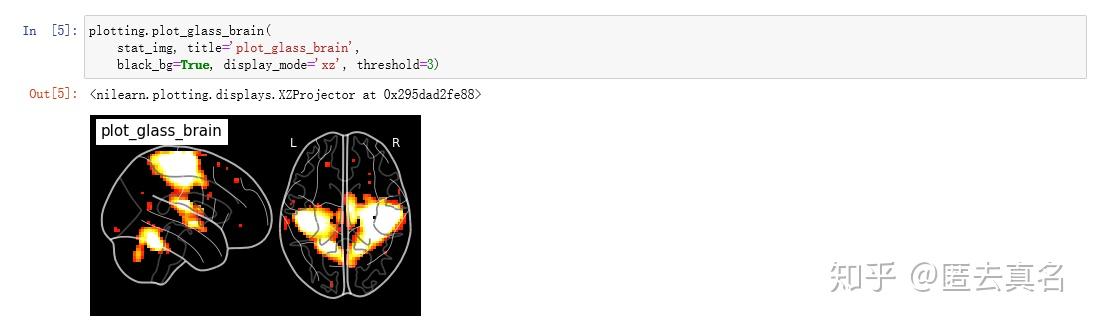 nilearn 笔记（3） - 知乎