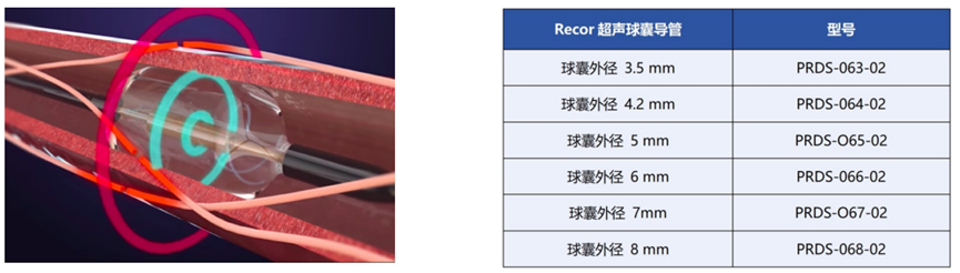 基于血管内超声的RDN代表性产品一览 - 知乎