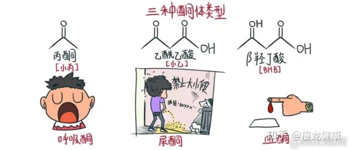 酮体有什么好处？哈佛学者Richard Veech告诉你…… - 知乎