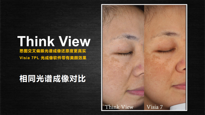 台湾ThinkView思图皮肤影像分析仪丨6光谱，让皮肤检测更精确 - 知乎