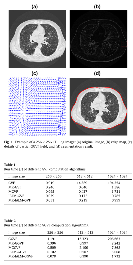 Fast gradient vector flow computation based on augmented Lagrangian method - 知乎