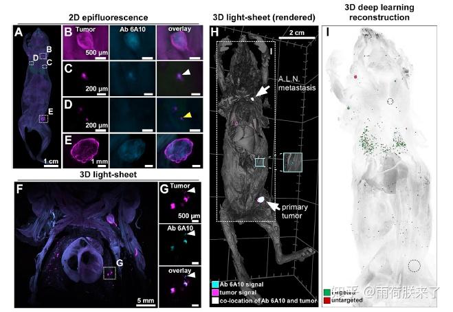 vDISCO和DeepMACT是什么鬼？说是可以让科学家看清全身所有癌症转移 - 知乎