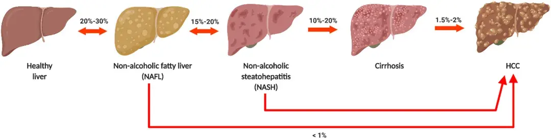 【病理专题】肝脏组织学及 NASH动物模型病理检测 - 知乎