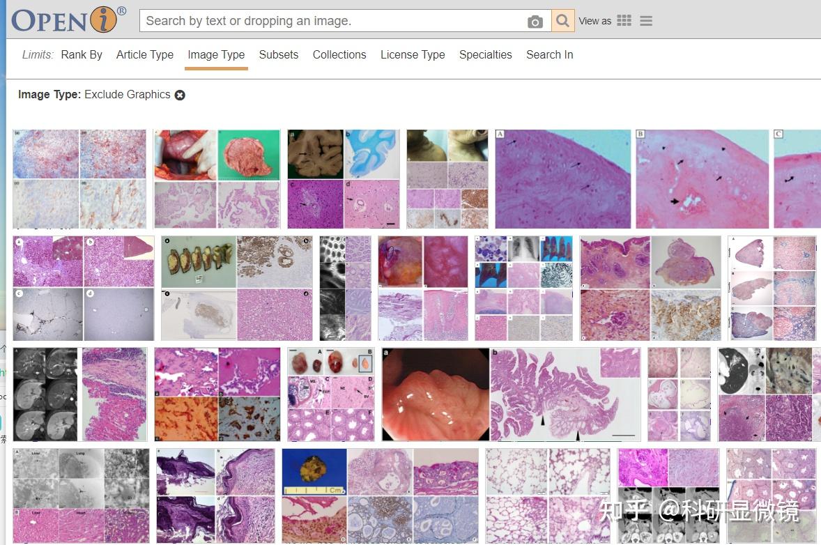 SCI写作-利用NCBI下的网页OPENI进行图片检索，制作高大上的流程图，反向检索文献 - 知乎