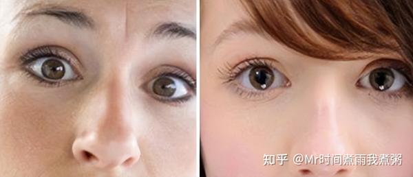 揭晓:超声炮原理是什么?超声炮做一次多久见效果?别胡来 知乎