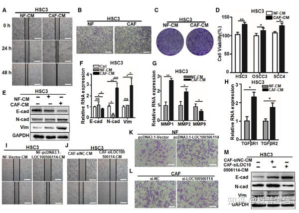 2022年最新肿瘤相关成纤维细胞(CAFs)生信思路多角度总结 - 知乎