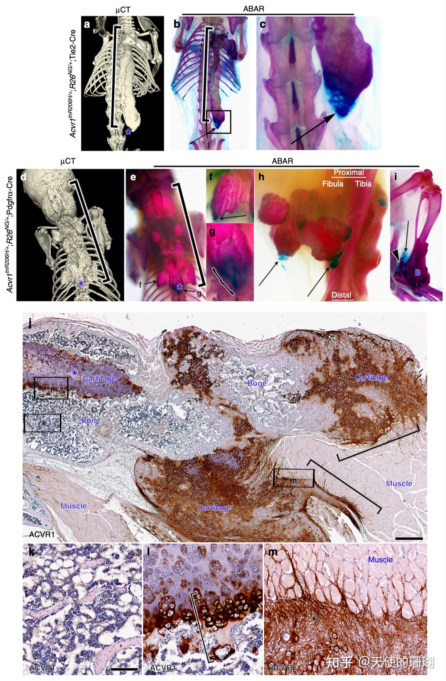 纤维成脂祖细胞中的激活素依赖性信号导致了FOP - 知乎