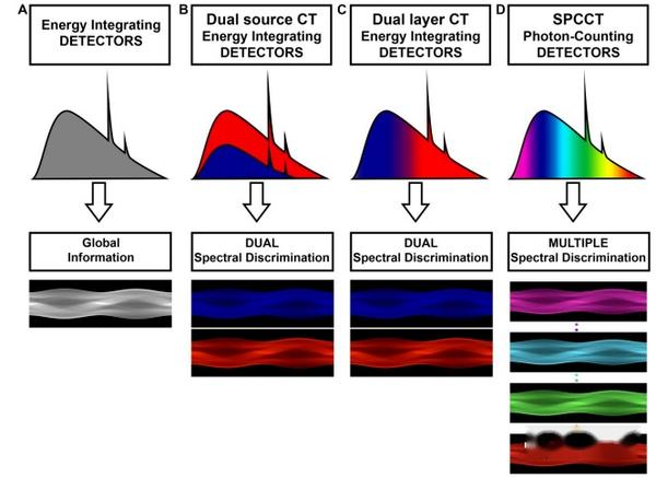收藏！全球CT技术变迁史 - 知乎