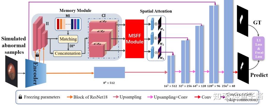顶会精选！工业异常检测最新SOTA方案分享（无监督/框架/小样本） - 知乎