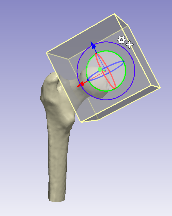 【Simpleware】教程：导入和放置 CAD 植入物：股骨近端 - 知乎