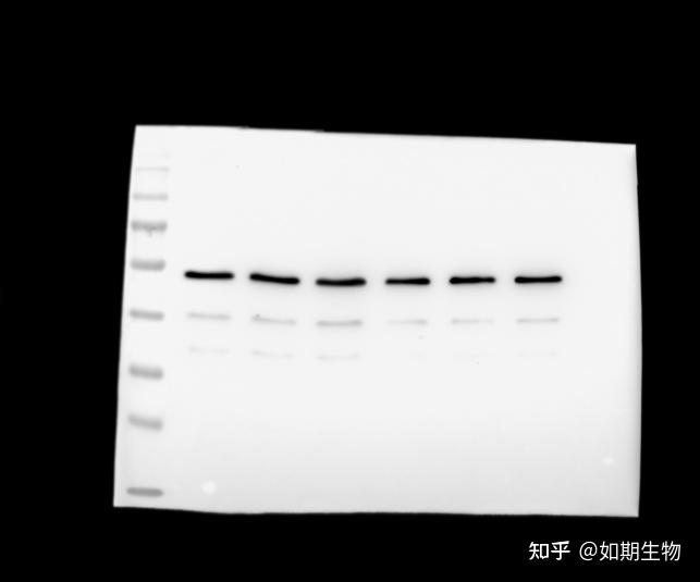 WB蛋白质印迹法(Western blot)实验方法及检测报告模板 - 知乎