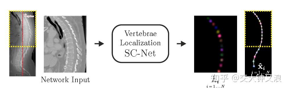 Coarse to Fine Vertebrae Localization and Segmentation with SpatialConfiguration-Net and U-Net - 知乎