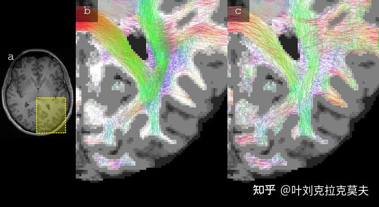 科学可视化软件介绍 – 医学图像处理和可视化开放软件框架MRtrix3 - 知乎