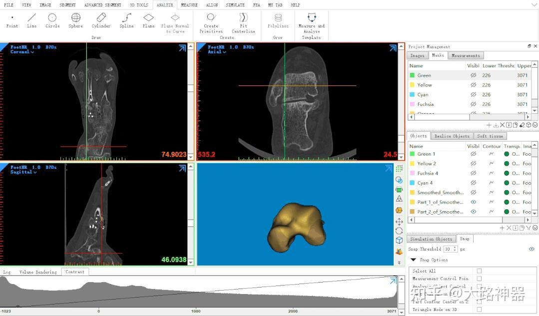 dcm是什么格式？怎么从医院拷贝dicom？医院dcm文件在电脑怎么打开？ - 知乎