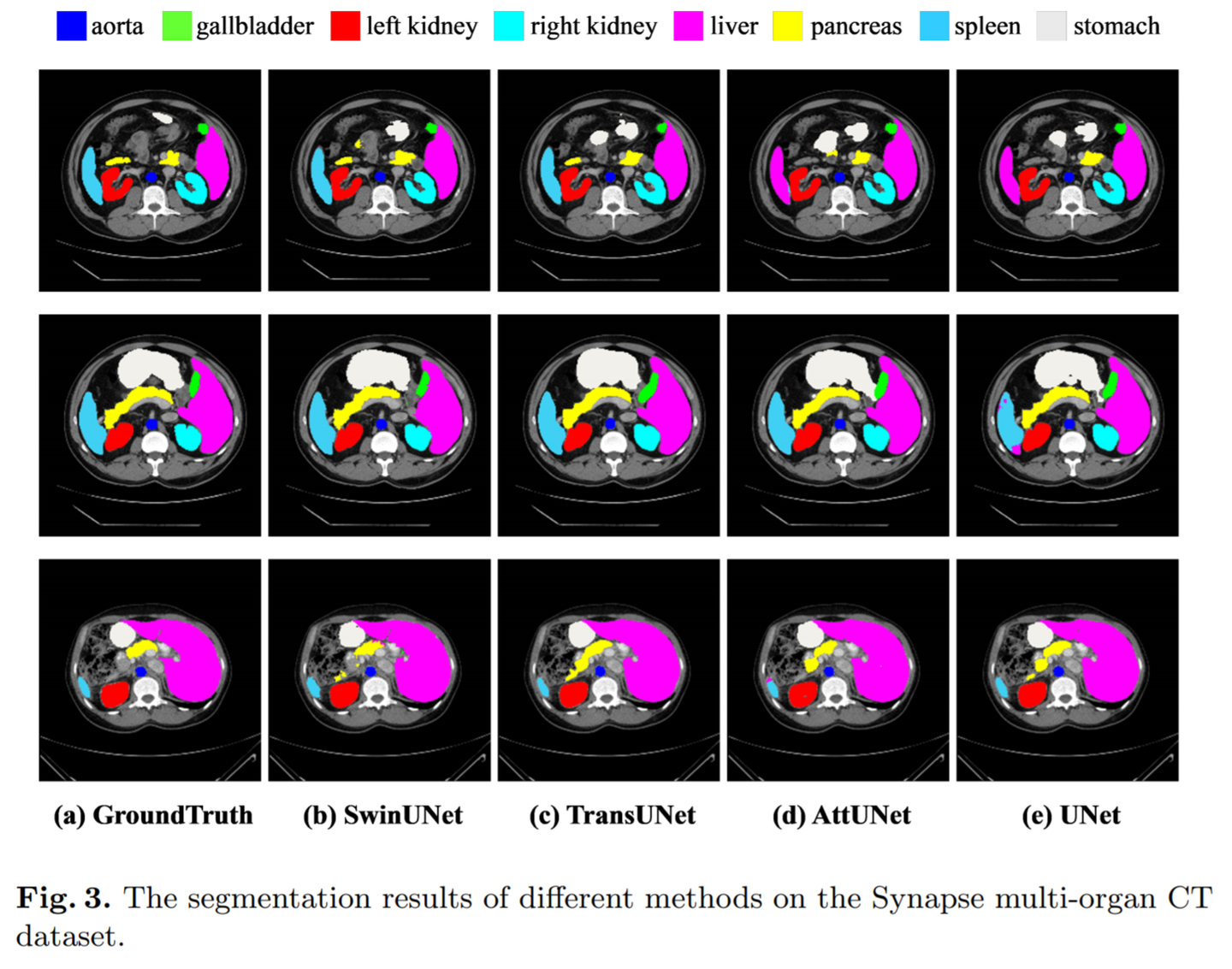 【论文速递12-08】医学图像分割方向优质的论文及其代码 - 知乎