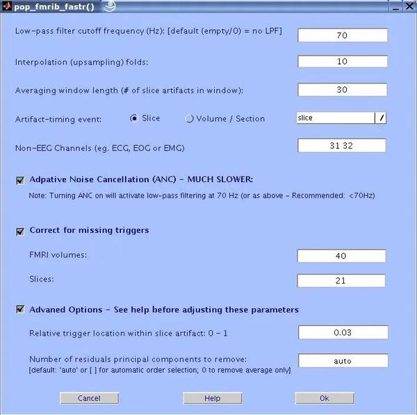 同步脑电-功能磁共振（EEG-FMRI）伪影去除方法及工具箱介绍 - 知乎