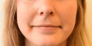 FACS-Facial Action Coding System 面部表情编码系统 各AU(Action Unit)说明 - 知乎