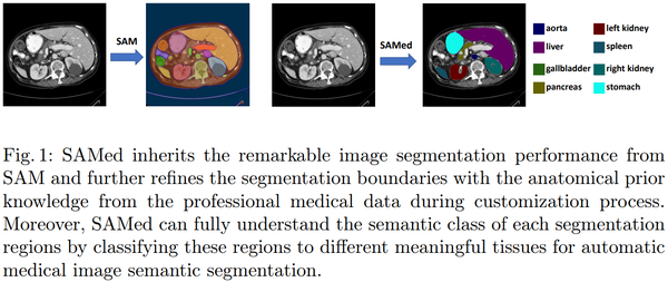 【arXiv 2304】为医学图像分割定制的Segment Anything Model（SAMed） - 知乎