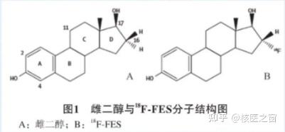 18F-FES PET/CT靶向核素显像助力ER阳性乳腺癌精准诊断 - 知乎