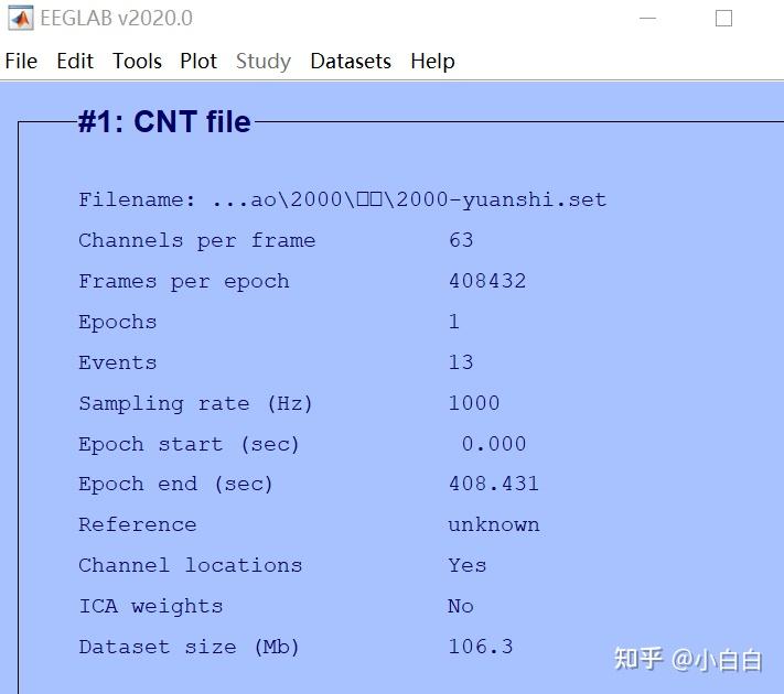 如何获得脑电导联的.loc文件-电极坐标文件 - 知乎