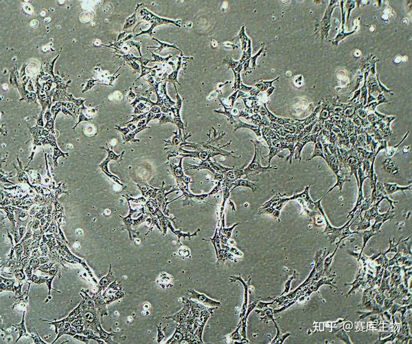 赛库细胞学堂|人体乳腺癌模型---4T1 - 知乎