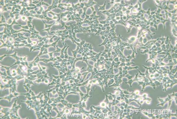细胞学堂 | 脱落的293T细胞如何恢复正常 - 知乎