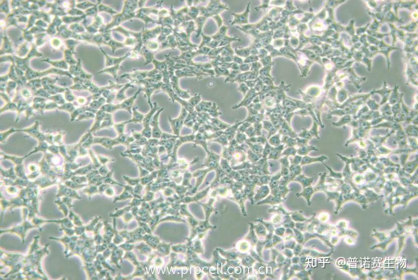 细胞学堂 | 脱落的293T细胞如何恢复正常 - 知乎