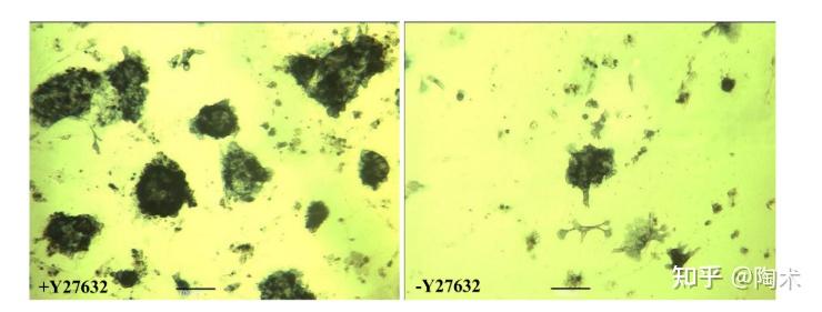 TargetMol明星分子——Y-27632 & Y-27632 2HCl - 知乎
