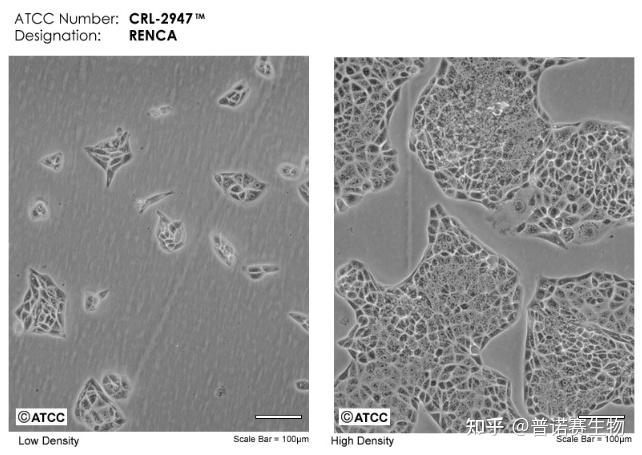 细胞学堂 | Renca细胞培养时形态异常怎么办 - 知乎
