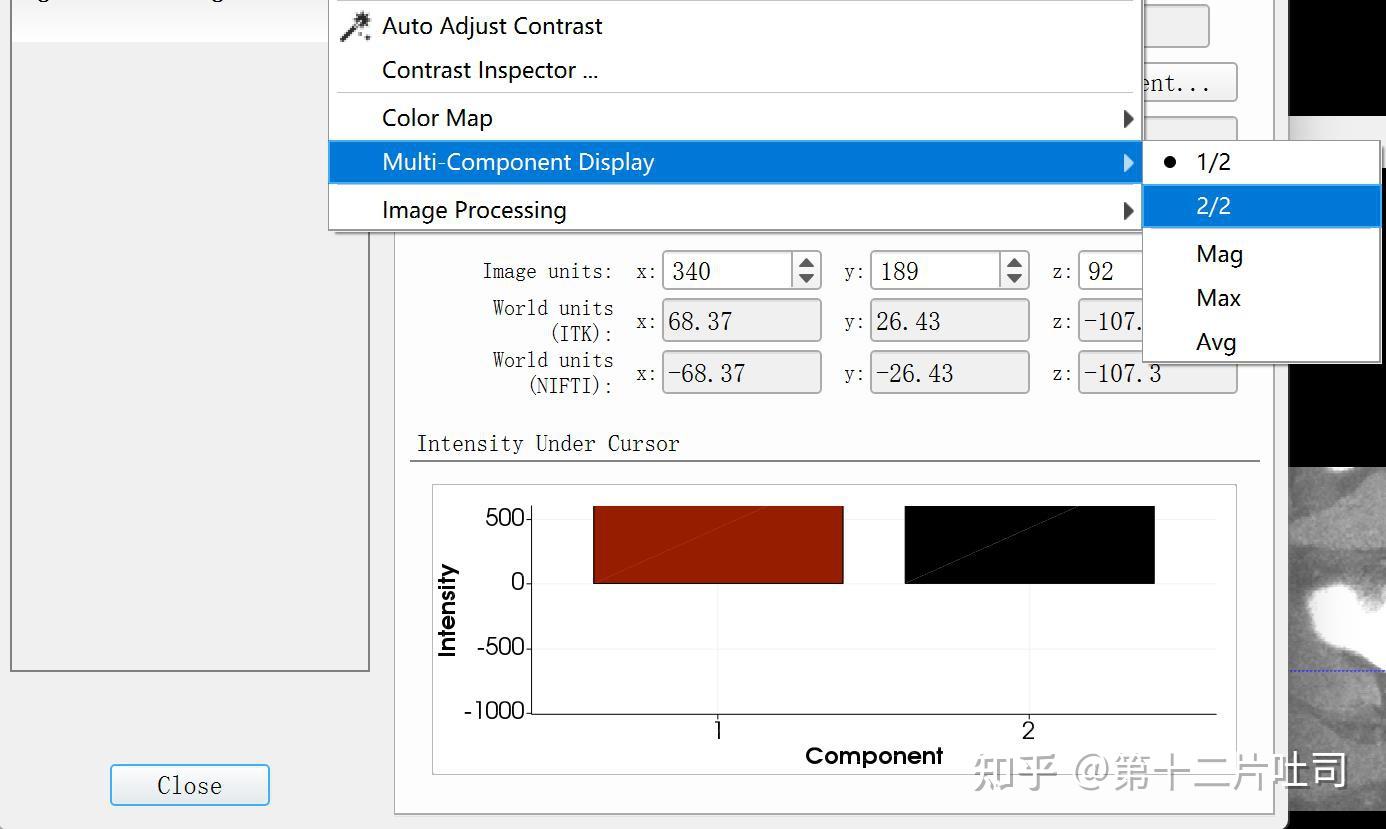 医学影像：ITK-SNAP如何查看“四维”nii文件 - 知乎