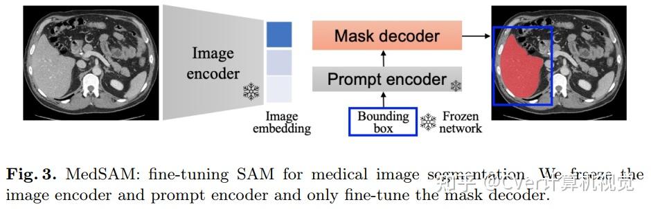 MedSAM：分割医学图像中的一切 - 知乎